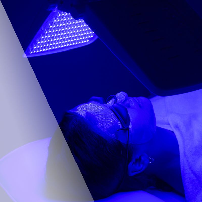 LED Light Therapy & Acupuncture: A Perfect Pairing » Franklin ...